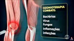 Especial Ozonioterapia no Programa Sílvio Santos – Ozonioterapia Porto Alegre