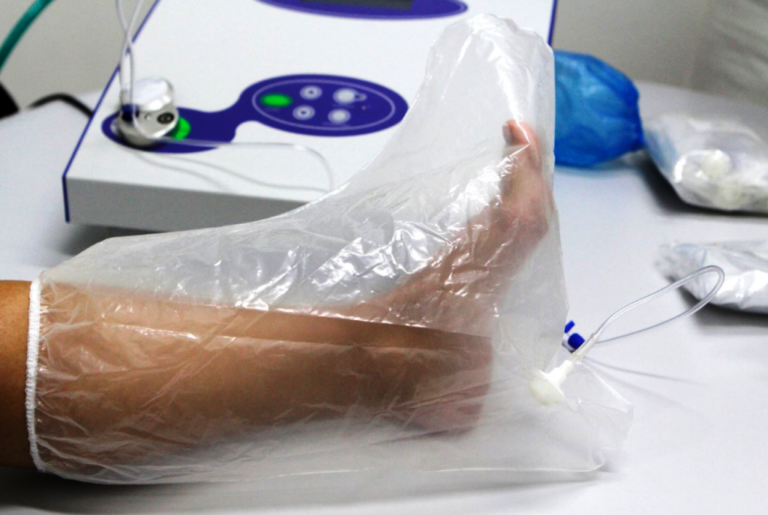 Ozonioterapia aliada no tratamento das micoses – Ozonioterapia Porto Alegre